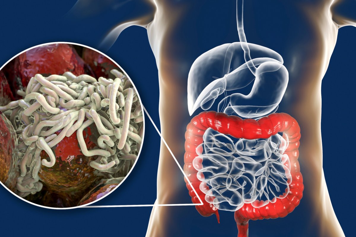 Pediatra: owsiki są wszędzie - Wywiad | Adamed Expert