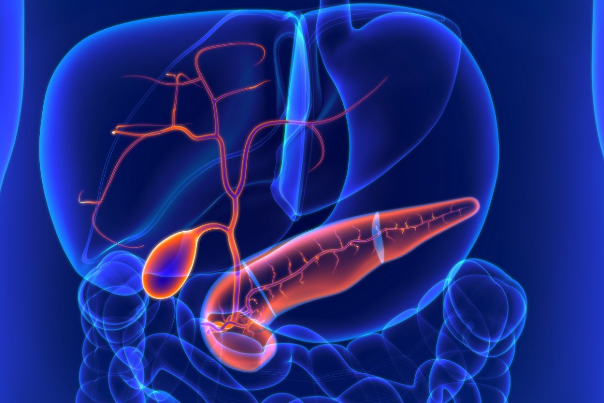 Torbiele trzustki – objawy, przyczyny i leczenie