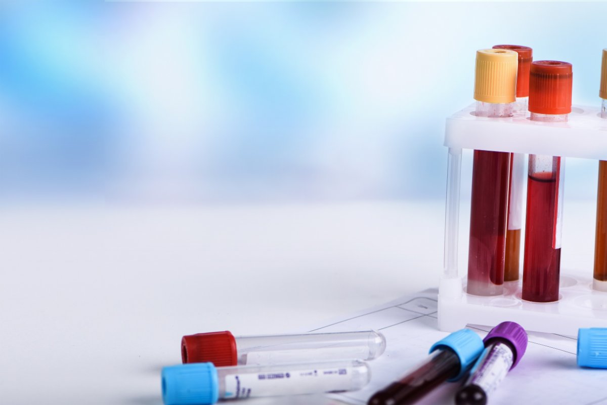Antykoncepcja hormonalna – jakie badania… - Publikacja | Adamed Expert